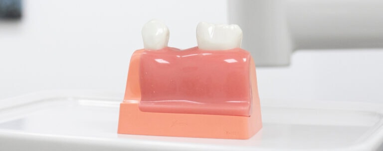 Dental implants in Morningside | Replace missing teeth